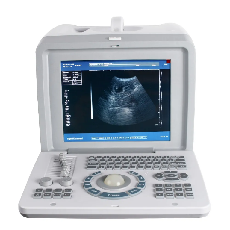 Ultrasound Machine Price in Pakistan - Surgicals.Pk